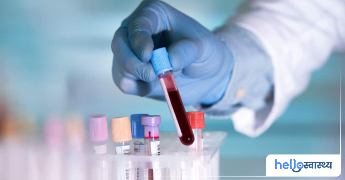 Glycohemoglobin Test: ग्लाइकोहीमोग्लोबिन टेस्ट क्यों की जाती है? - हैलो ...